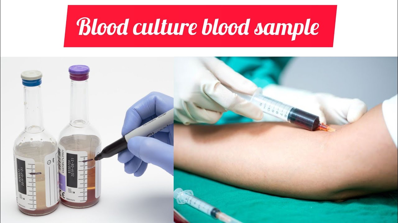 Watch How to take blood for blood CS sample 💉🩸⚕️💊 - YouTube