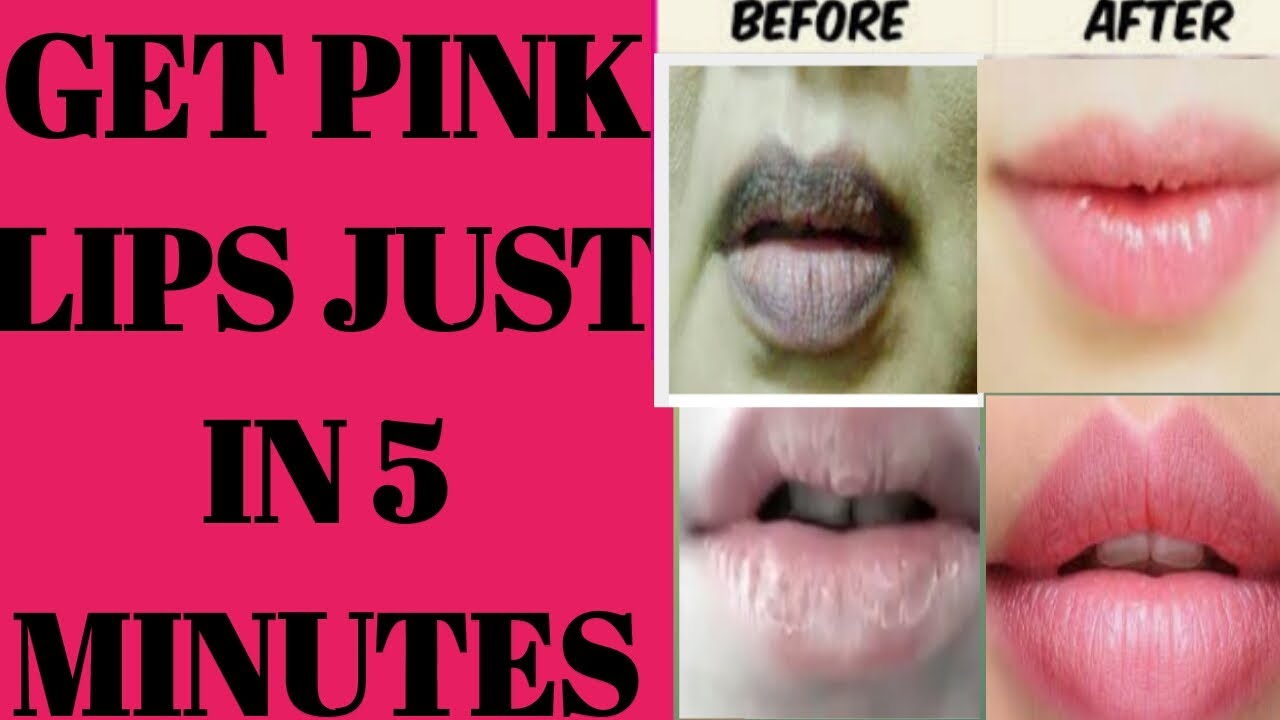 How to get pink lips/ Lighten dark lips naturally at home/ Get Rid Of ...