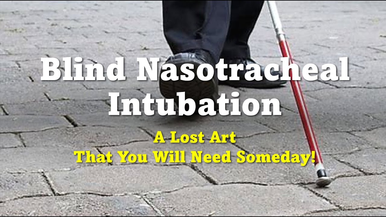 Blind Nasotracheal Intubation Cadaver Demonstration - YouTube
