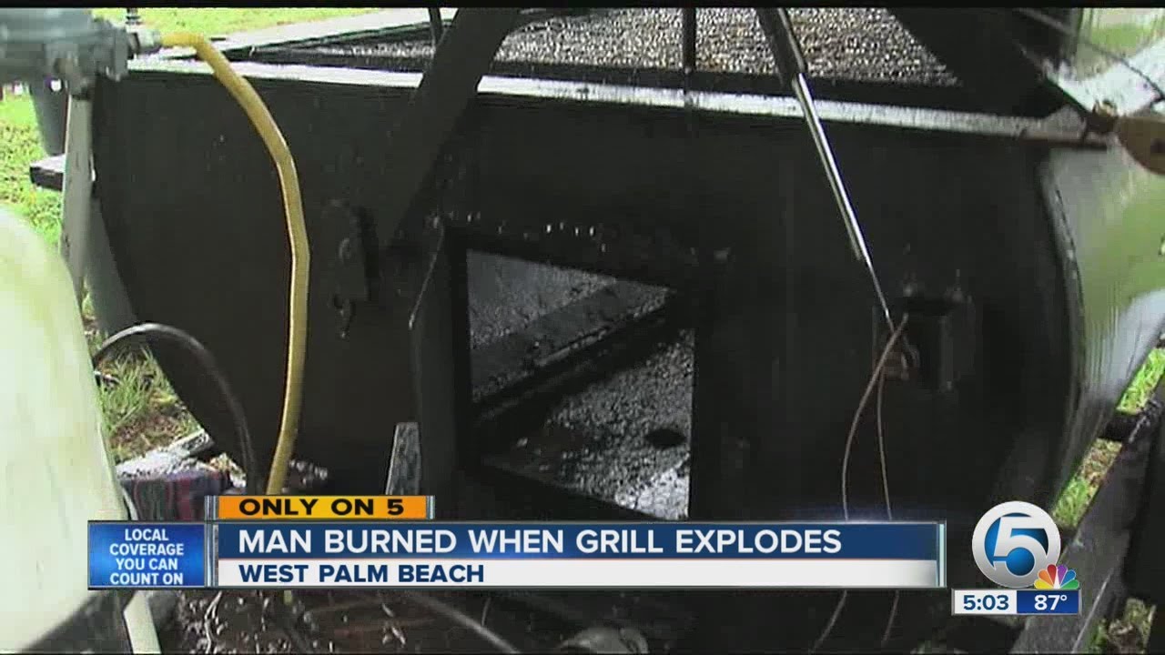 Man burned when grill explodes - YouTube