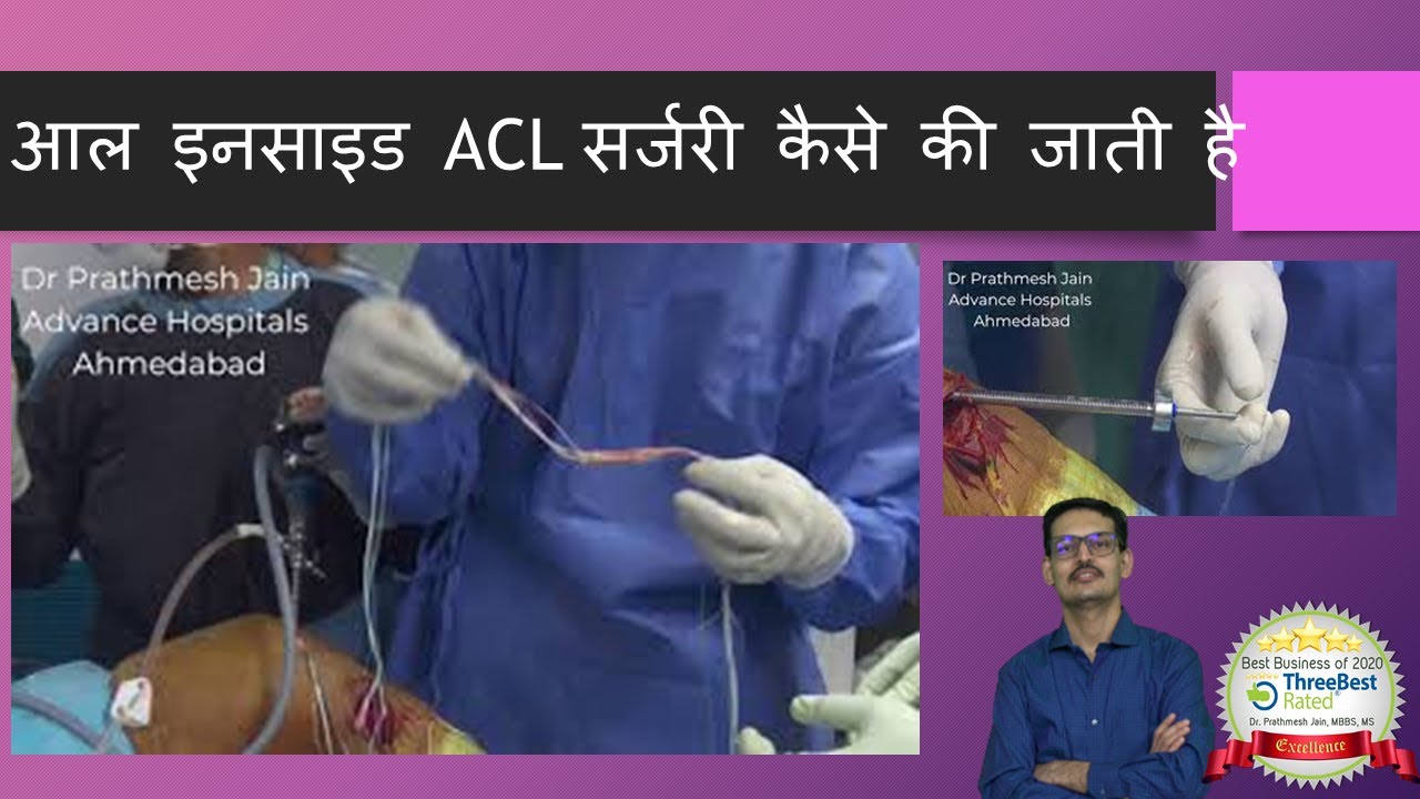 Live All Inside ACL surgery, Fibertape Internal Brace (Hindi) Procinch ...