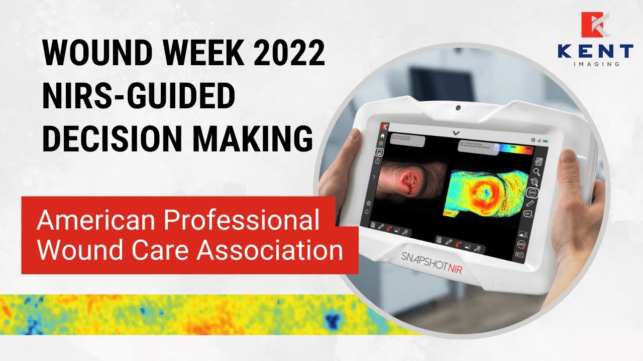 APWCA's Wound Week 2022: NIRS Guided Decision-Making and Conferring ...