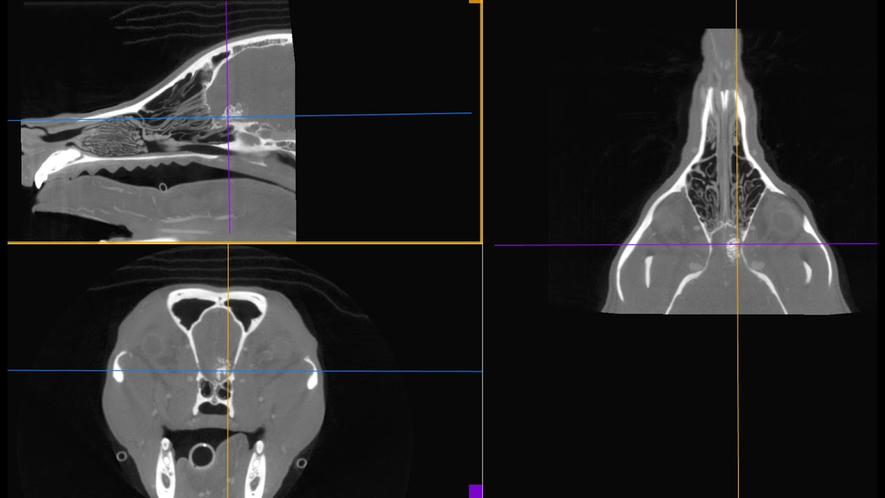 Brain mass discovered during Vimago HDVI CT scan for routine dental ...