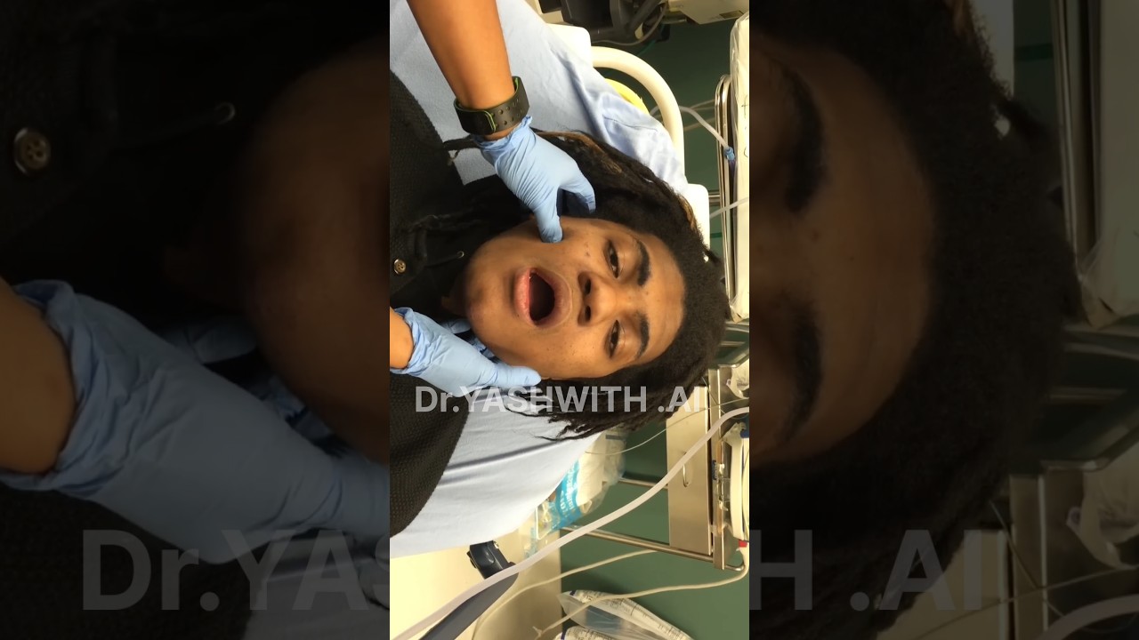 Trick of the Trade approach to reducing an anterior mandible ...