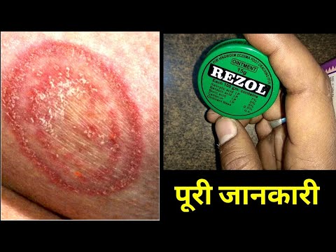 rezol ointment uses and side effects in hindi - YouTube