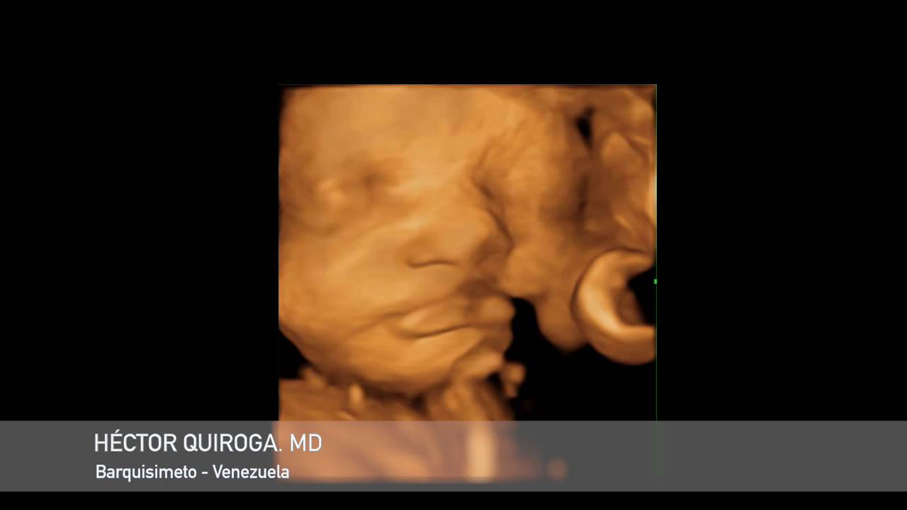 Ecografìa 4D en un feto de 29 semanas - YouTube