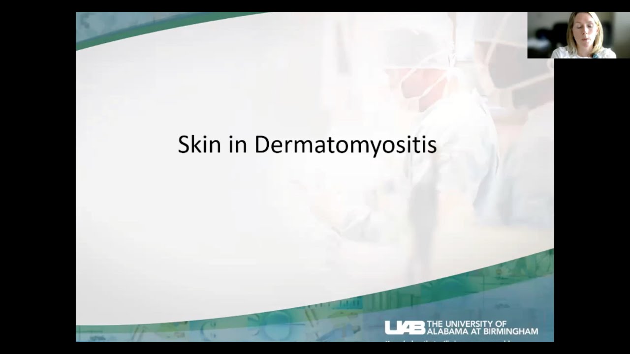 Myositis and the Skin - YouTube