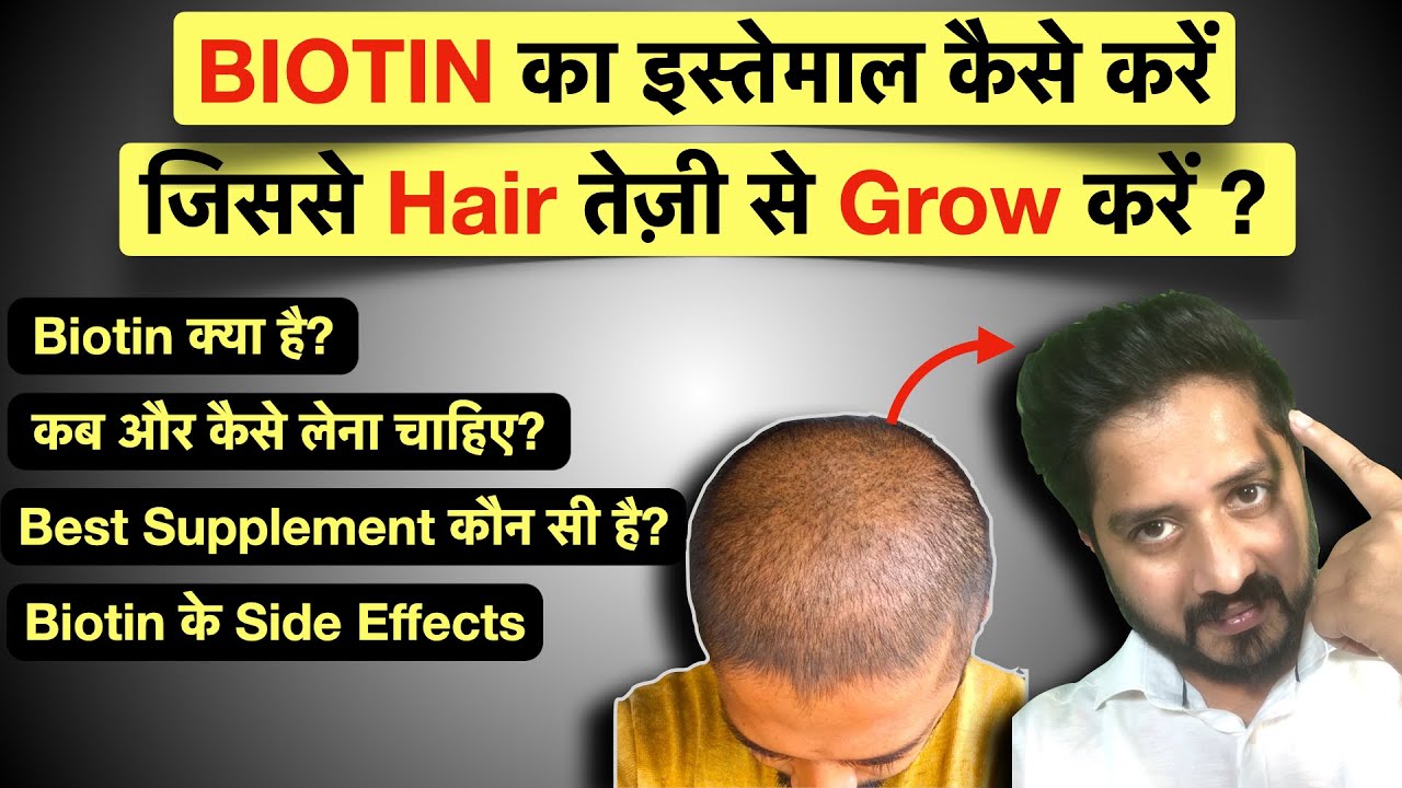 What is Biotin (Vitamin B7)? How effective is Biotin for Hair Growth ...