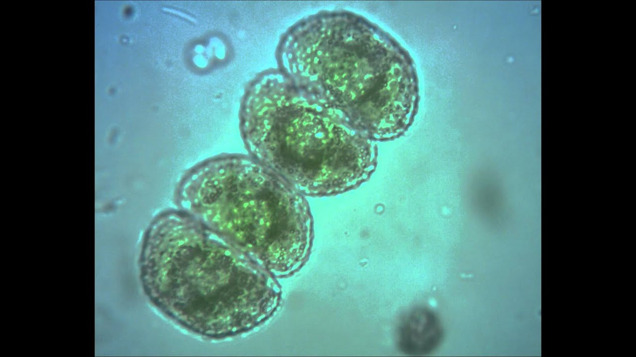 Green Algae. Cosmarium: cytoplasmic streaming? - YouTube