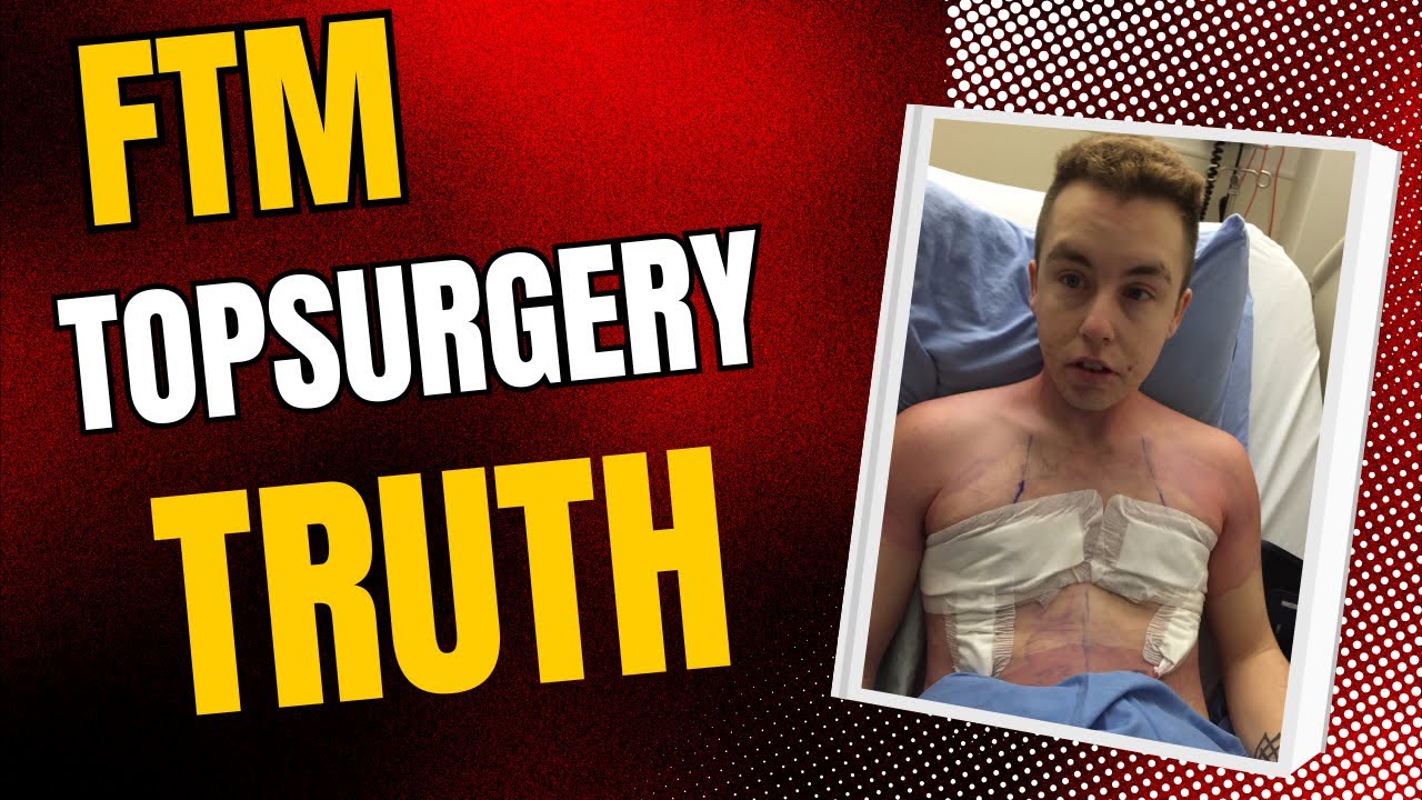 FTM: 2 Months Post Op - YouTube