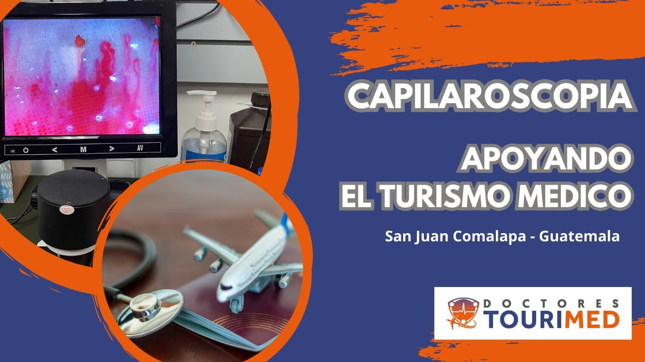 Descubre la CAPILAROSCOPIA en el Turismo Médico | Doctores TOURIMED ...