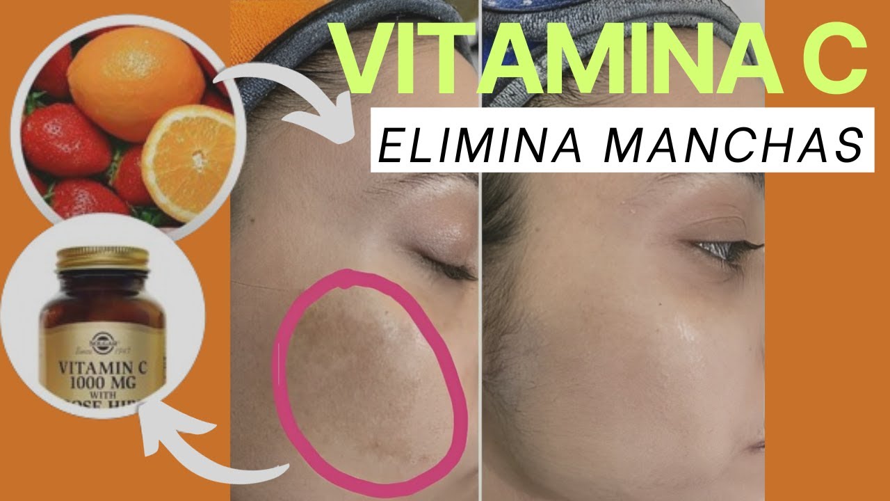 Suero De Vitamina C Para La Cara Image To U