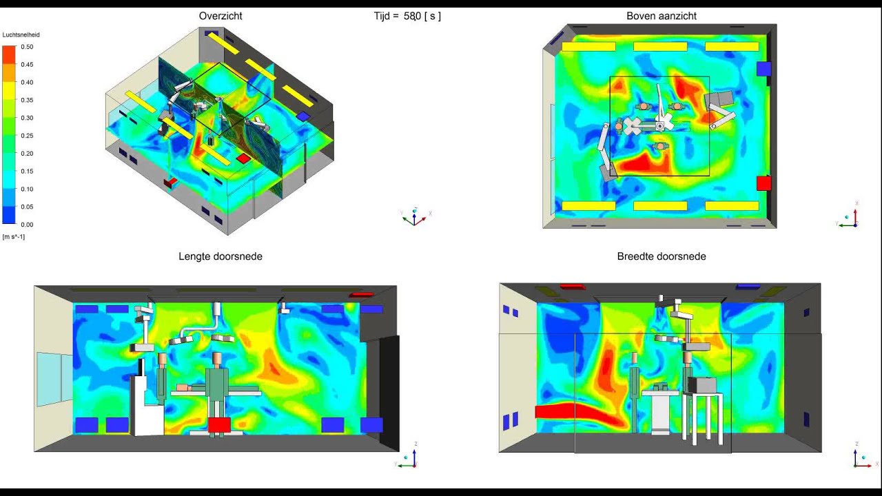 Air movement simulation Operating Room by ONE Simulations - YouTube