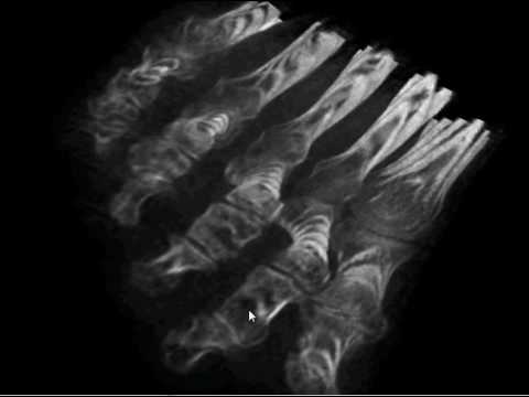 MRI Voxel Real-Time Rendering - YouTube