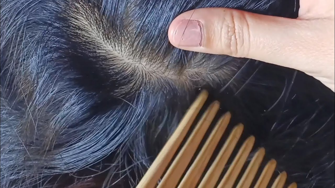 ASMR Hair Care: Scratching Dandruff With Comb - YouTube