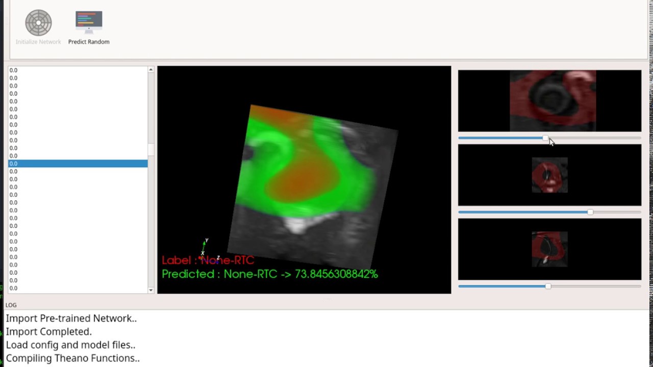 3D CNN Class Activation Map - YouTube