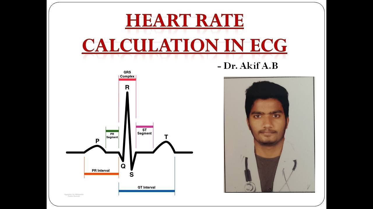 How To Calculate Heart Rate In ECG YouTube how-to-calculate-heart-rate-in-ecg-youtube
