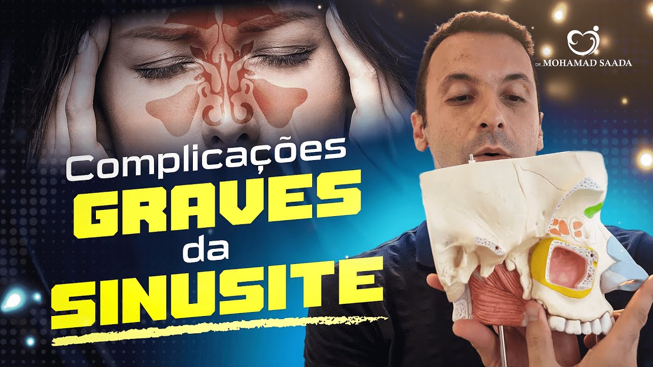 O QUE ACONTECE QUANDO NÃO TRATAMOS A SINUSITE? - YouTube