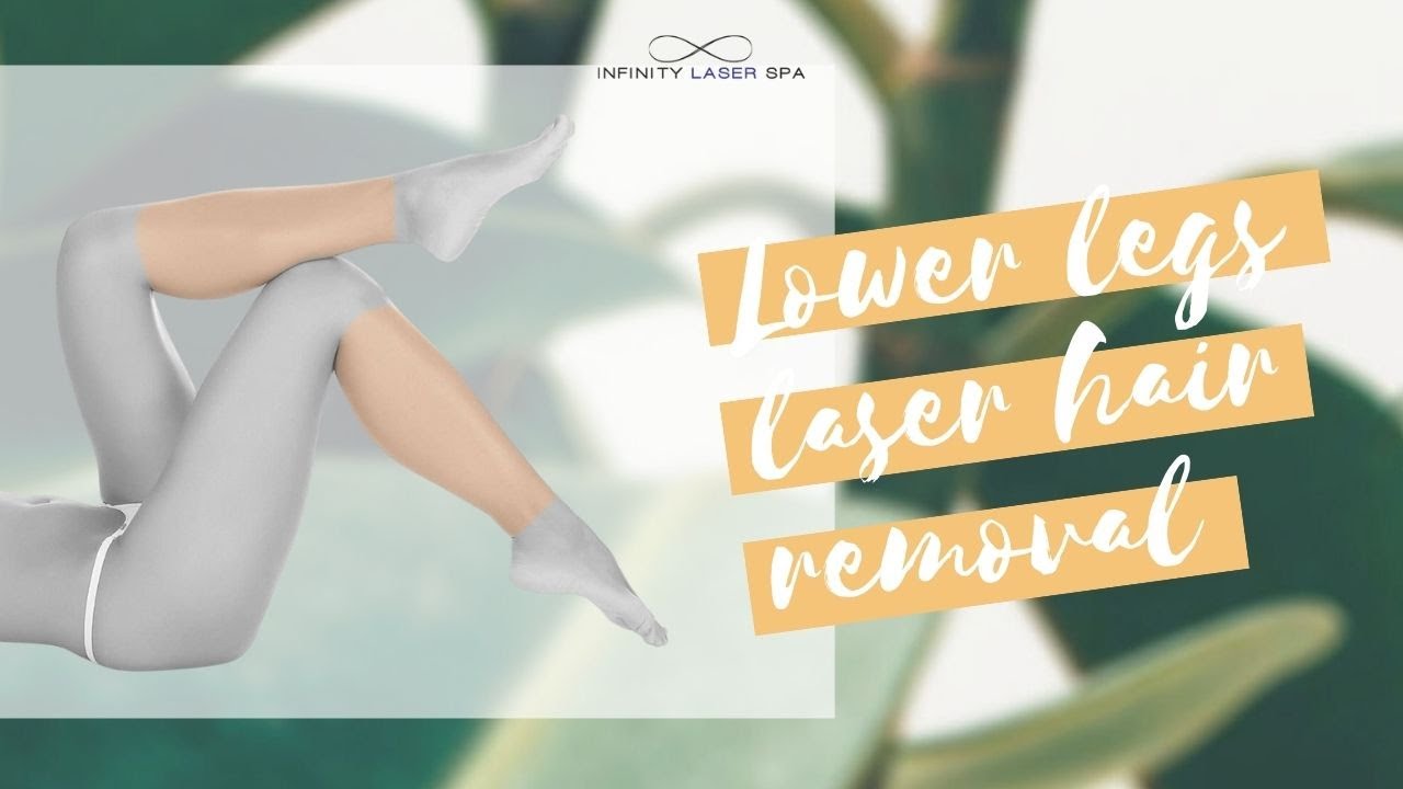 LOWER LEGS LASER HAIR REMOVAL - INFINITY LASER SPA IN NYC - YouTube