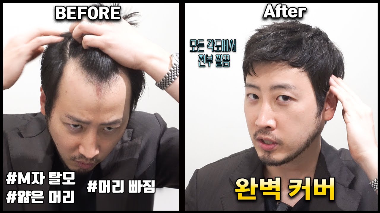 M자가 더 깊어졌다고요 커버하면 되죠 어떤 M자도 커버 가능한 헤어 스타일링 방법 대공개 남자탈모 헤어스타일 커버 영상 M자탈모 짧은 머리로 커버하는 방법 스턴컷