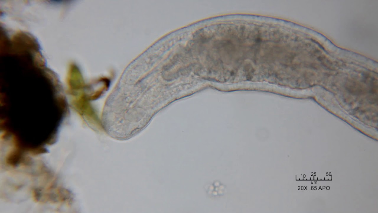 Pond Life Through the Microscope: Flatworm 5 - YouTube