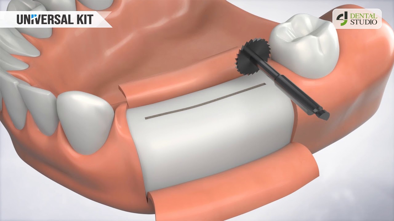 Universal Kit 통합 - YouTube