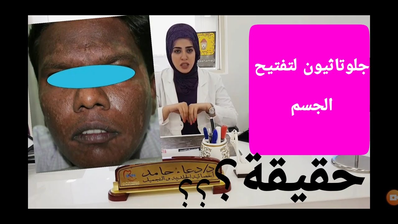 حقن الجلوتاثيون للتفتيح Youtube