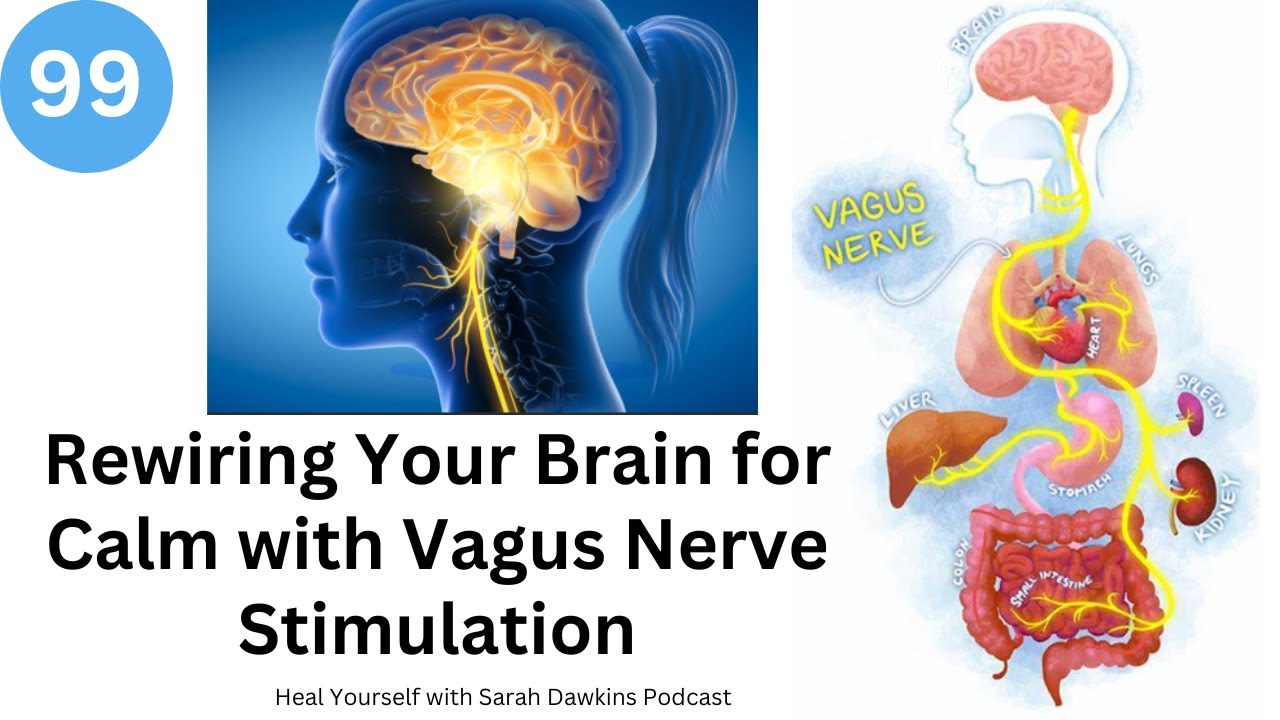 Rewiring Your Brain for Calm with Vagus Nerve Stimulation #99 - YouTube
