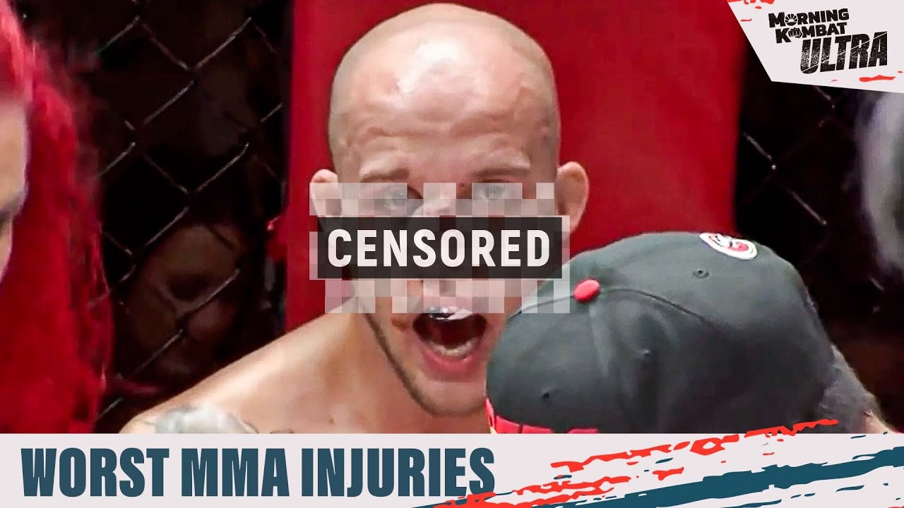 Breaking Down The Worst MMA Injuries Of All-Time | MK ULTRA - YouTube