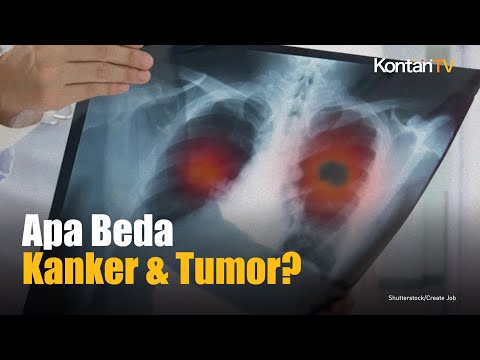 Inilah Perbedaan Kanker dan Tumor | Kontan News
