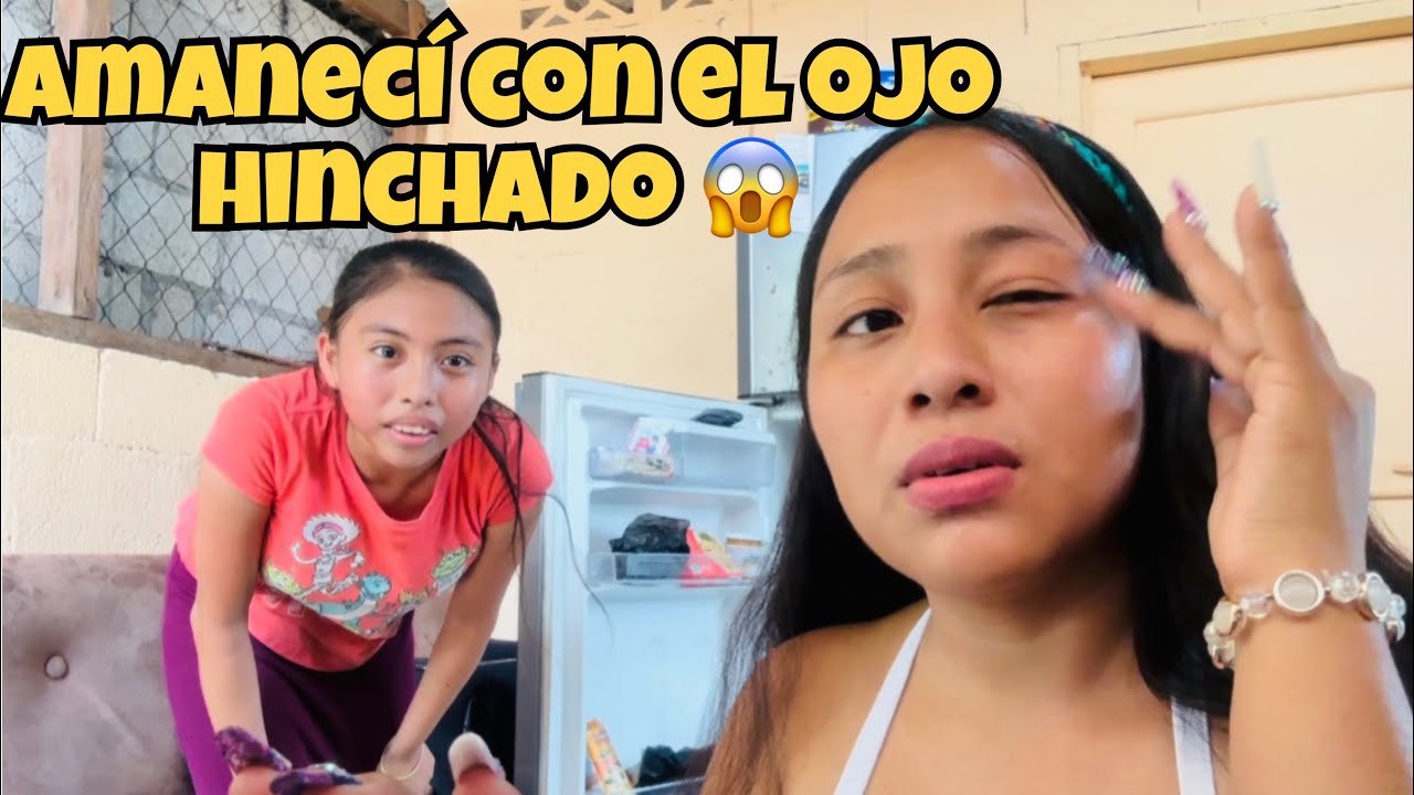 A Elida se le hinchó un ojo será xq se habrá enojado fuerte😥 Melany me ...