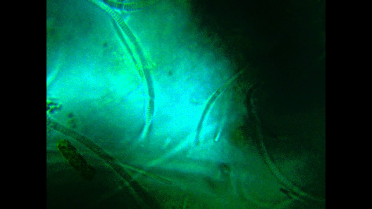 white stringy bacteria 23 - YouTube