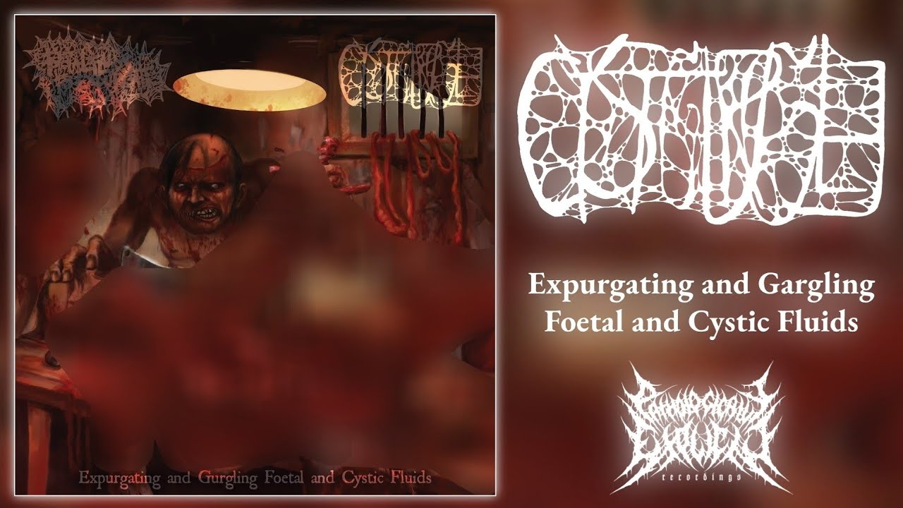 CYSTGURGLE - Expurgating and Gargling Foetal and Cystic Fluids [Split ...