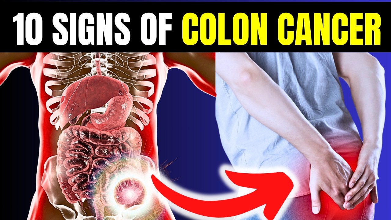 8 Warning Signs of Colon Cancer You Should Never Ignore - YouTube