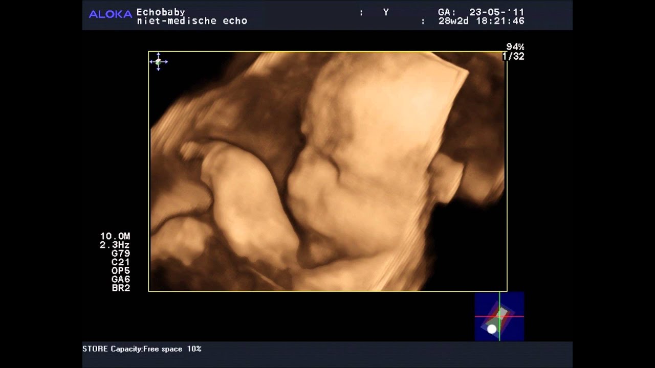 28 weken zwangerschap - YouTube