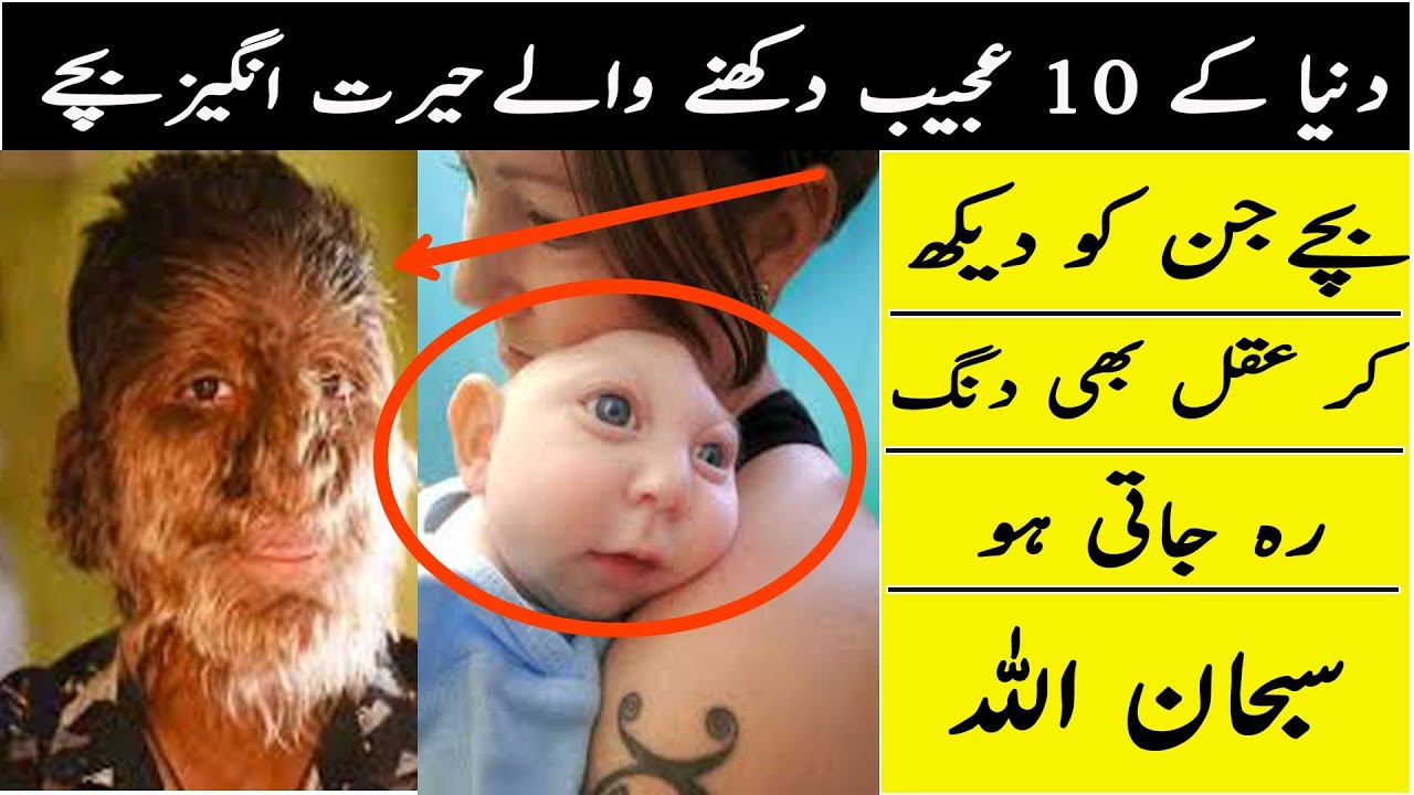 10 Most unusual kids that actually exist in the world || Infomatic ...