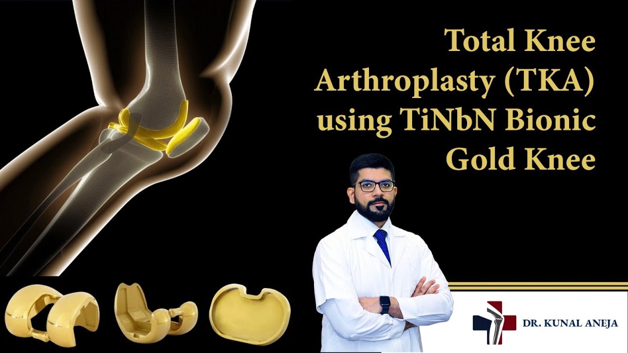 PATIENT JOURNEY | Total Knee Arthroplasty (TKA) | TiNbN Bionic Gold ...