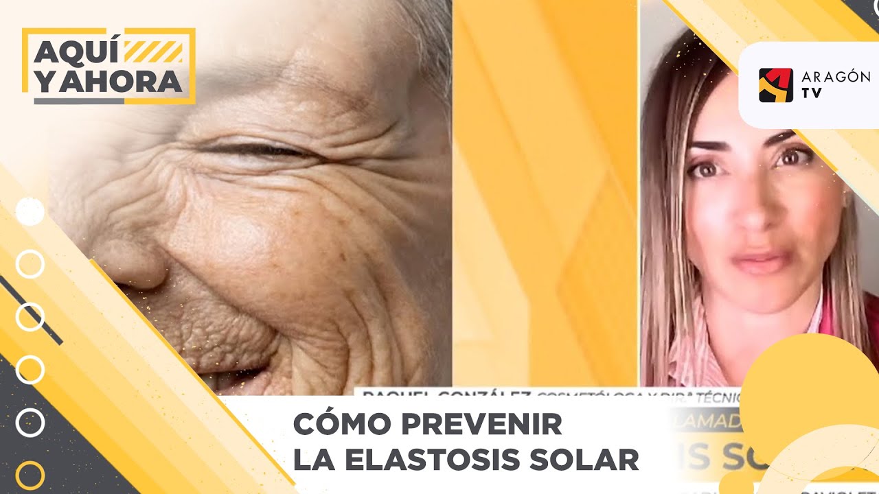 Cómo prevenir la elastosis solar - YouTube
