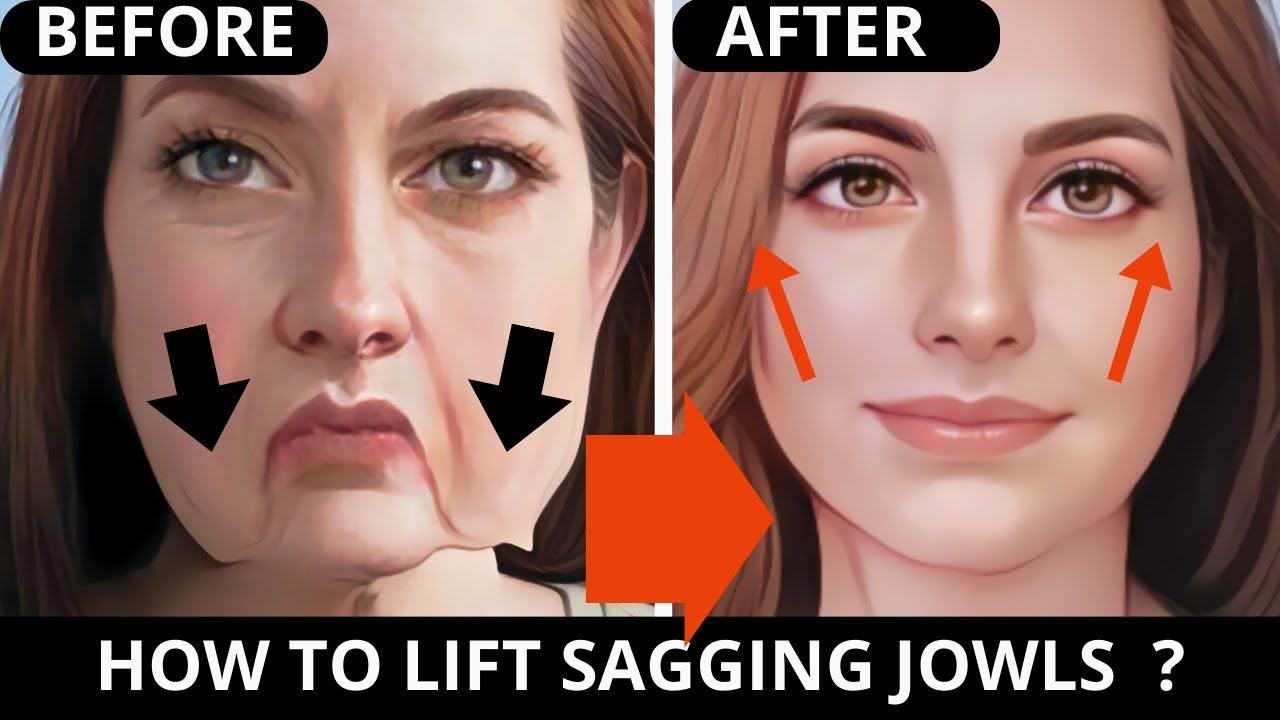 Tighten Sagging Skin & Jowls in 10 Minute | Anti-Aging Face Exercises ...