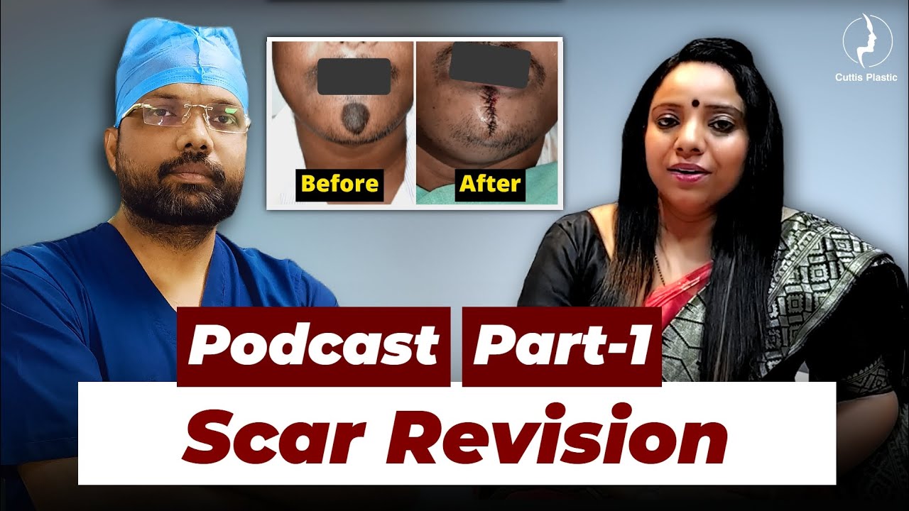 Scar Revision | Scar Removal Surgery | Burn Scar | Laser Surgery For ...