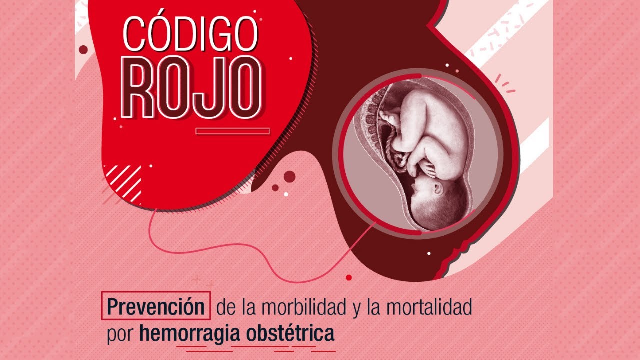 2 Extracción manual de placenta - YouTube