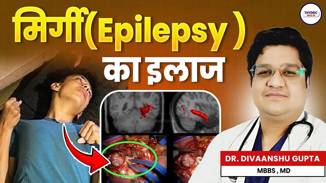 मिर्गी का इलाज कैसे होता है | मिर्गी की जांच और इलाज | Mirgi Treatment ...