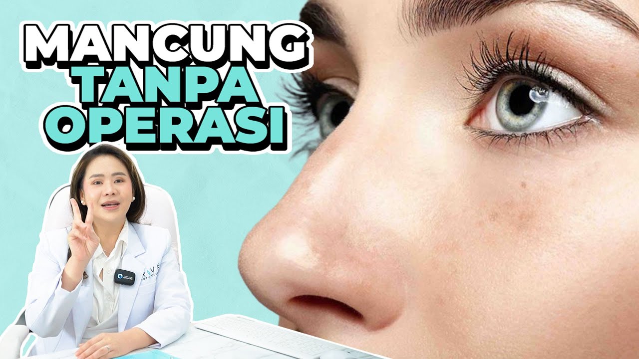 2 CARA AGAR HIDUNG JADI MANCUNG (TANPA OPERASI) - YouTube