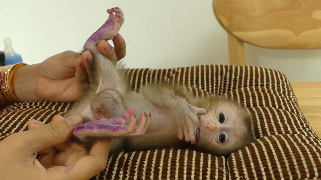 Because Of Walking Shusy Got Rash, Mom So Worry & Take Good Care For ...