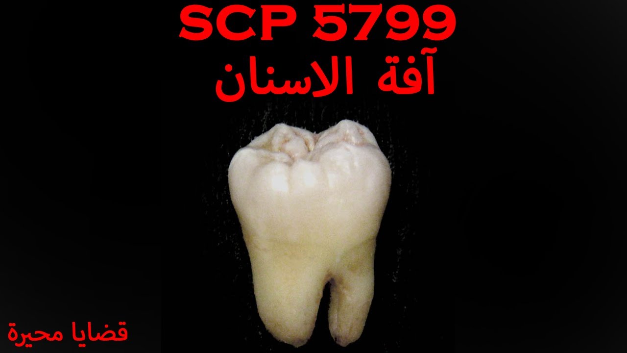 الكائن SCP-5799 | آفة الاسنان المفترسة | منظمة SCP - YouTube