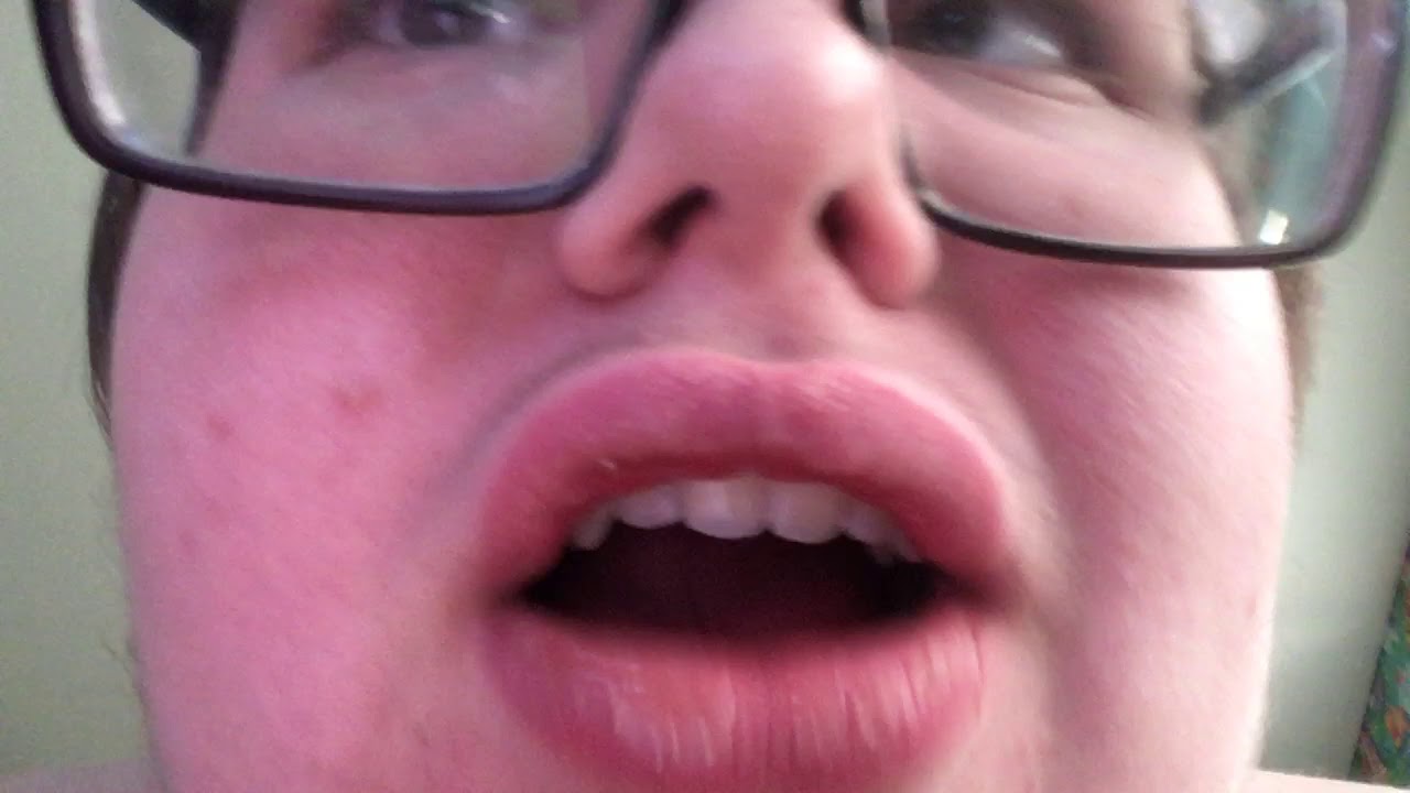 AN ANGRY MESSAGE TO “THAT BALD GAMER”!!!!! 😡😡😡😡😡 - YouTube