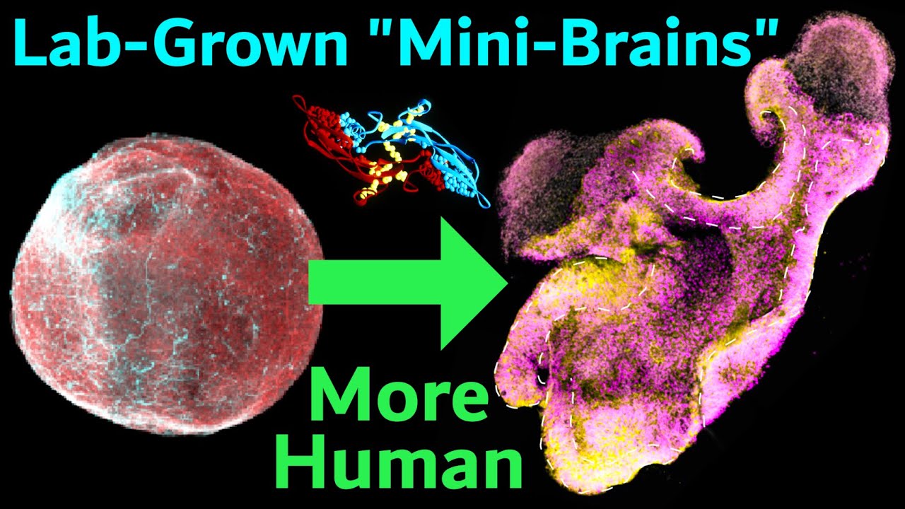 New Technique Makes Brain Organoids More Like Real Human Brains ...