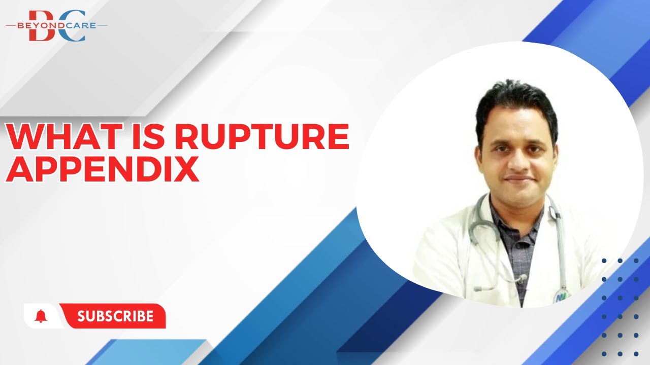 What You Need to Know About Ruptured Appendix | APPENDICITIS ...