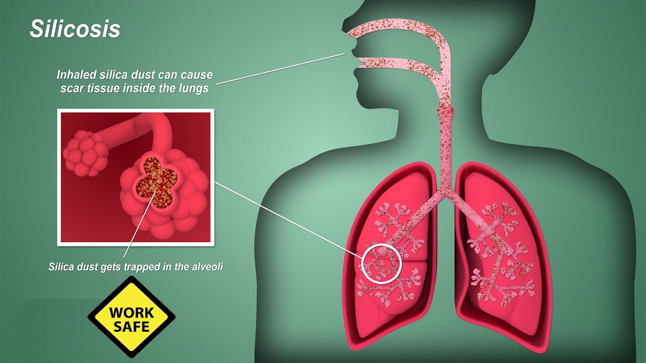 Respiratory Protection In The Workplace | Silica Dust Safety Awareness ...