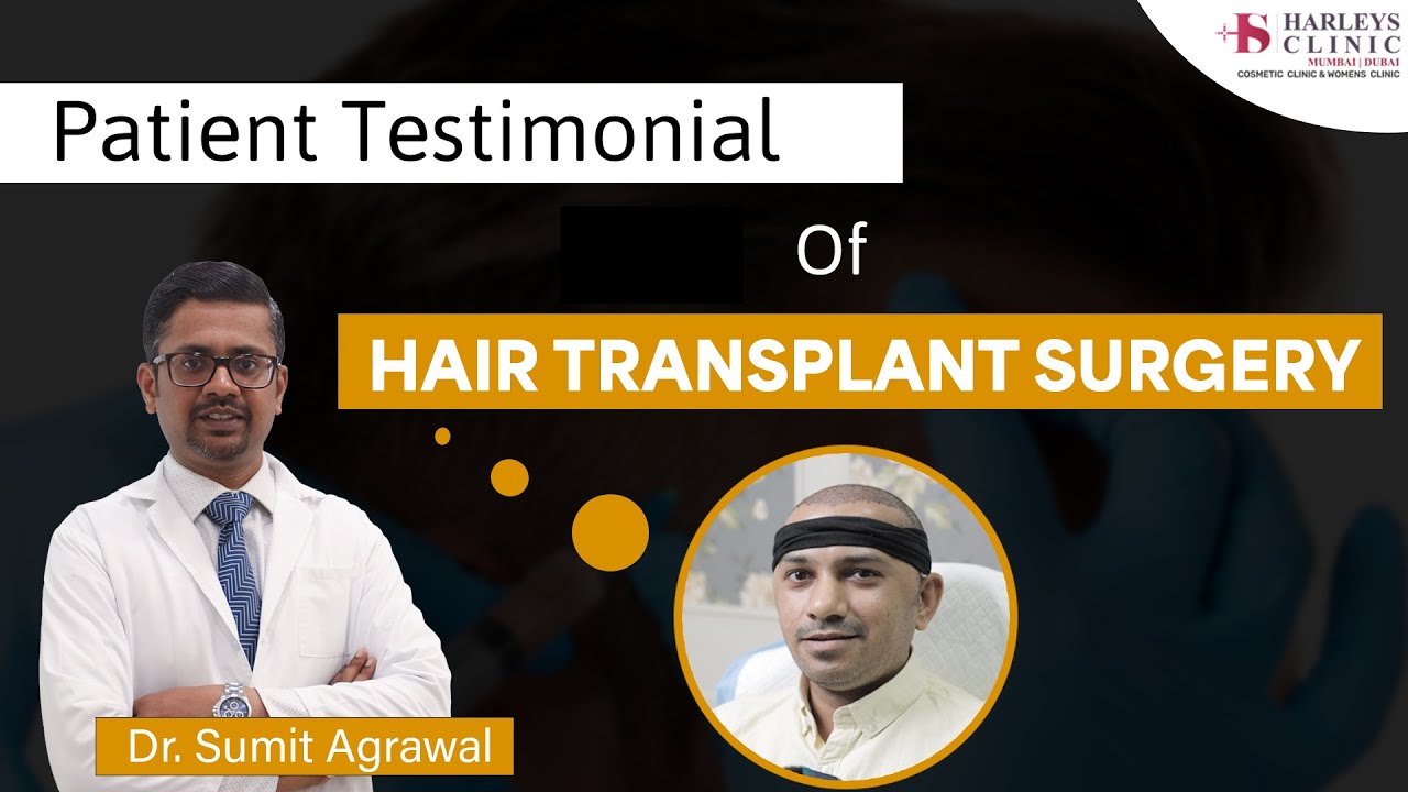 Life-Changing Results | Patient Testimonial | Hair Transplant Surgery ...